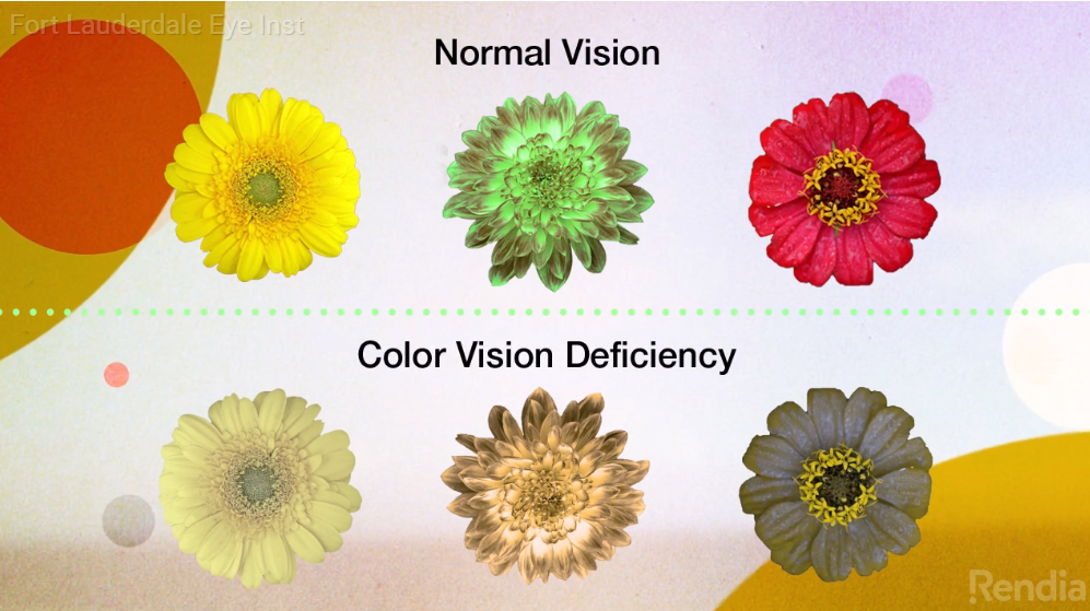Color Blindness Causes And Diagnosis Fort Lauderdale Eye Institute Color Blindness Causes And Diagnosis Fort Lauderdale Eye Institute