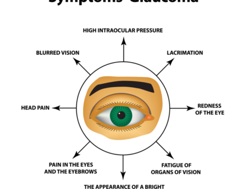 Angle-Closure Glaucoma - Fort Lauderdale Eye Institute