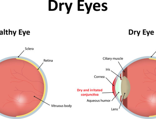 Dry Eyes: Causes and Treatments - Fort Lauderdale Eye Institute