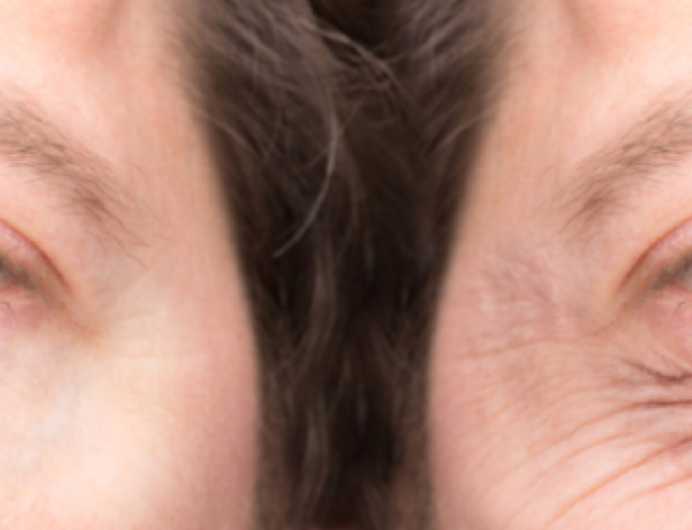 Aqueous Humor and its Role in the Eye - Fort Lauderdale Eye Institute